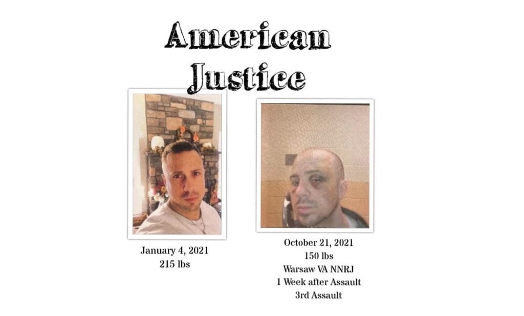 J6 Political Prisoner Ryan Samsel Can't Walk, Suffers Life Threatening ...